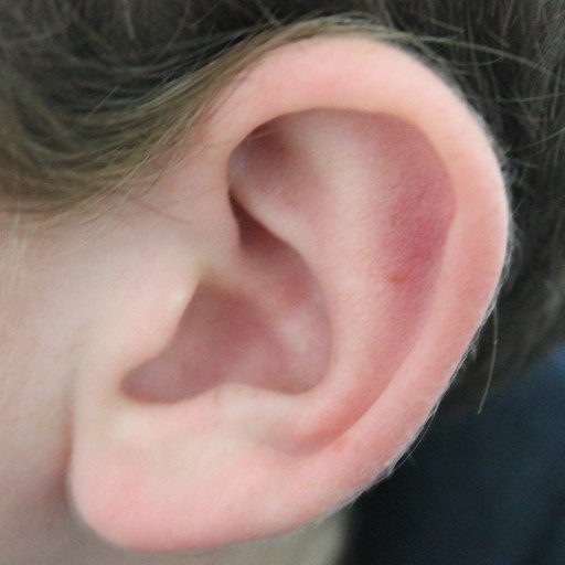 How Old Are Your Ears? - HEARING LOSS JOURNAL