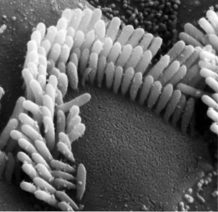 Seeking a cure for hearing loss: A progress report - HEARING LOSS JOURNAL